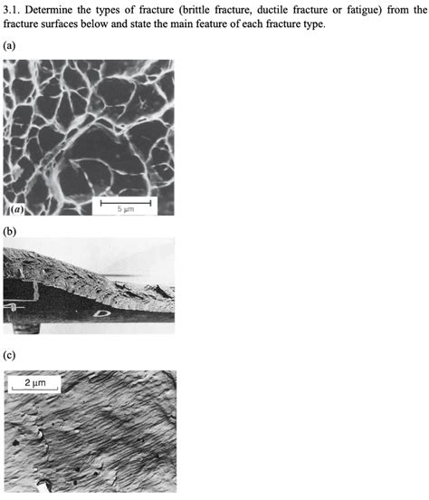 Solved Please Determine The Fracture Type Which One Is