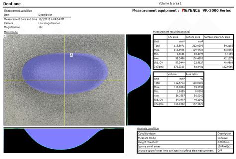 Image And Measurement Of Erosion Download Scientific Diagram