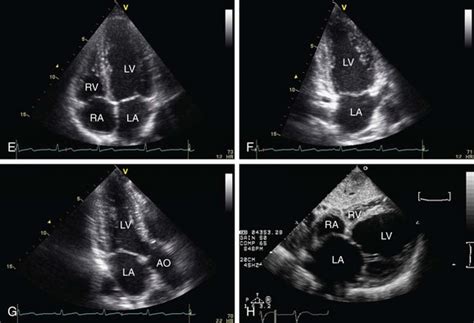 Echocardiography Radiology Key