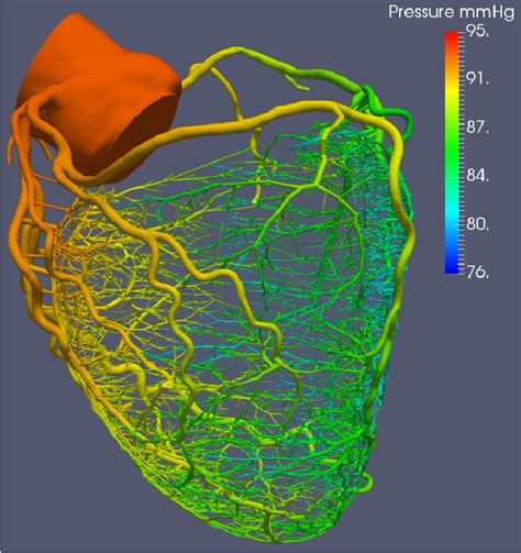 Figure 1 From Generation Of Patient Specific Cardiac Vascular Networks A Hybrid Image Based And