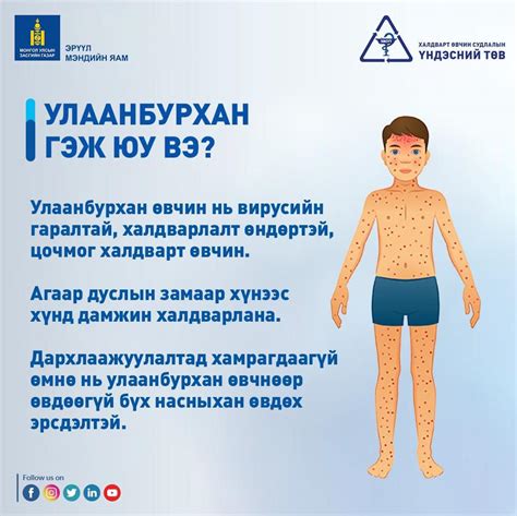 ️ ️ ️УЛААНБУРХАН Халдварт Өвчин Судлалын Үндэсний Төв Facebook