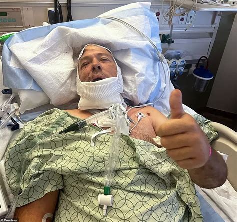 Montana Grandpa Whose Jaw Was Ripped Off By Bear Attacks Recovery