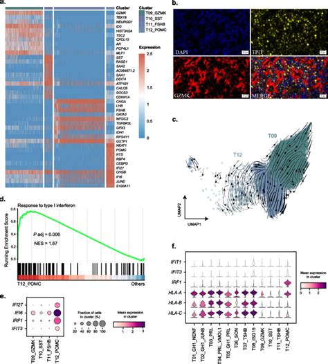 Single Cell Transcriptomic Analysis Reveals Tumor Cell Heterogeneity