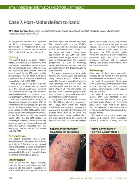 Case 7 Post Mohs Defect To Hand