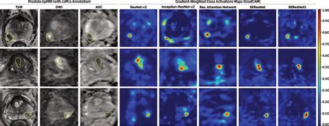 Model Interpretability Of The Candidate Cnn Architectures For Download Scientific Diagram