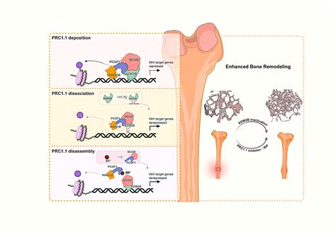 Researchers Identify A Prc1 1 Inhibitor For Treating Bone Deterioration