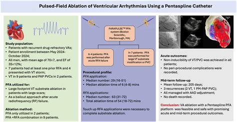 Pulsed Field Ablation With A Pentaspline Catheter For Ventricular Arrhythmias First Us Series