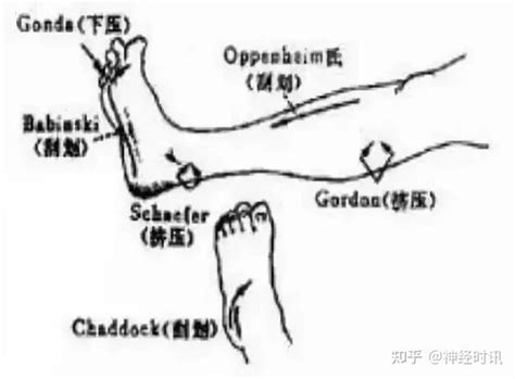 临床必备 神经系统体格检查一文详解 知乎