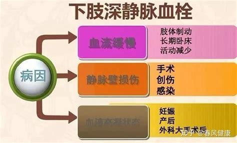 手术成功也需谨慎——结直肠癌术后护理之如何预防下肢静脉血栓 知乎