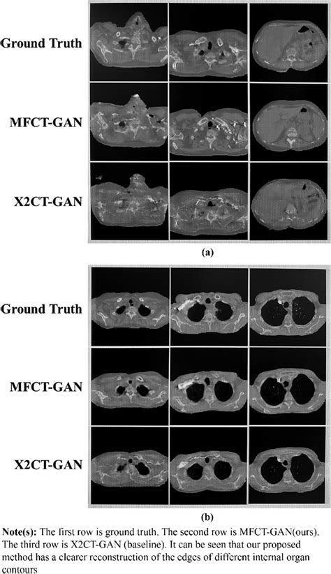 Comparison Of The Reconstruction Results Of The Two Methods Download