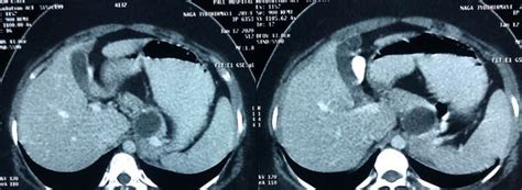 Success Stories Of Healing And Recovery Pace Hospitals Hyderabad