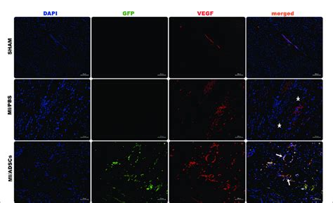 Vegf And Gfp Staining In Tissue Sections From Rabbit Heart Tissues In Download Scientific