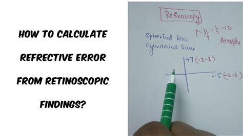 Prescription Retinoscopy Calculation At Roma Chauvin Blog
