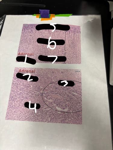 A P Lab Endocrine System Quiz Flashcards Quizlet