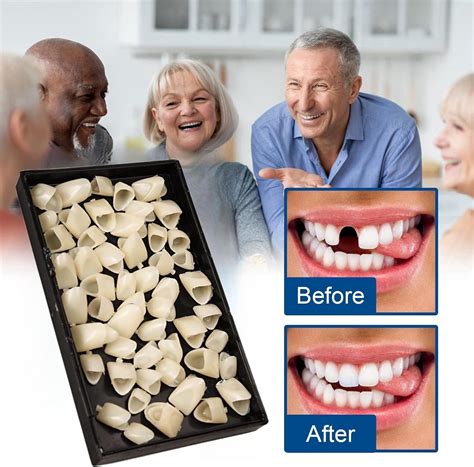 70pcs Tooth Repair Kit Temporary Tooth Crown Replacement Denture