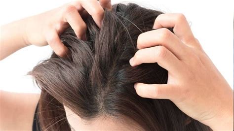 Pimples Issue सिर में होने वाले दाने करते हैं परेशान राहत के लिए इन घरेलू नुस्खों को अपनाएं