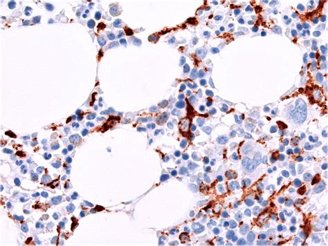 Histological Appearance And Distribution Of Histiocytic Cells In A Download Scientific Diagram