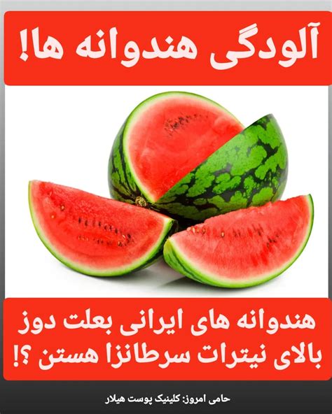 ‎حامد رئیسی‎ ‎اینم حقیقت هندوانه و گرفتاری که نیم وجب مجلسی آدم اونور دنبا واسه ما درست کرده