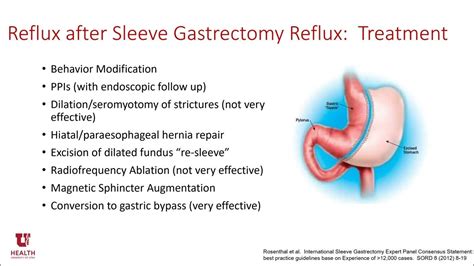 What To Do With Reflux After The Primary Bariatric Surgery Youtube