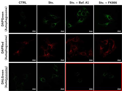 Autophagy Reagent Selection Guide Dojindo Laboratories