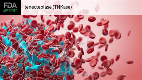Tenecteplase No Longer Off Label As Stroke Lytic