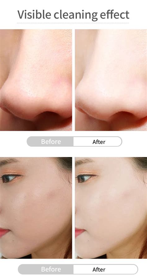 Очищающий Крем Детокс масло лосьон для массажа акне глубокое удаление черных точек очищающее