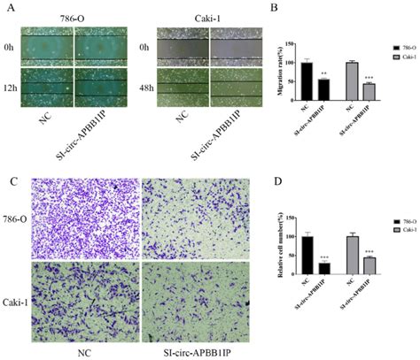 The Knockdown Of Circ Apbb1ip Inhibited Migration And Invasion In Ccrcc