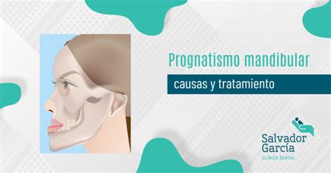 Desentrañando La Incisura Angularis