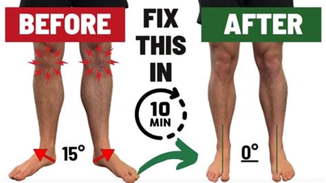 How To Fix Duck Feet FAST Fixing Ankle Dorsiflexion Tibial IR Hip IR GuerrillaZen Fitness