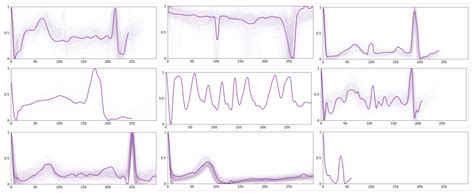 Prototype Learning For Medical Time Series Classification Via Humanmachine Collaboration