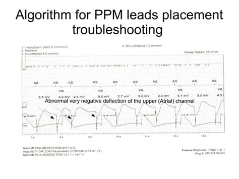 Ppm Ra Lead Troubleshooting Ppt
