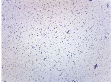 Staphylococcus Aureus Gram Pos Prepared Microscope Slide 75x25mm