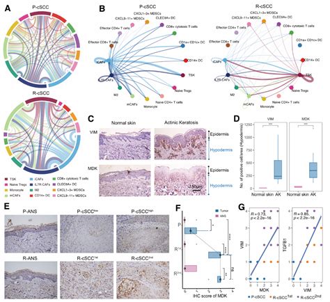 项目文章 单细胞测序揭示皮肤鳞状细胞癌复发相关的免疫微环境变化 知乎