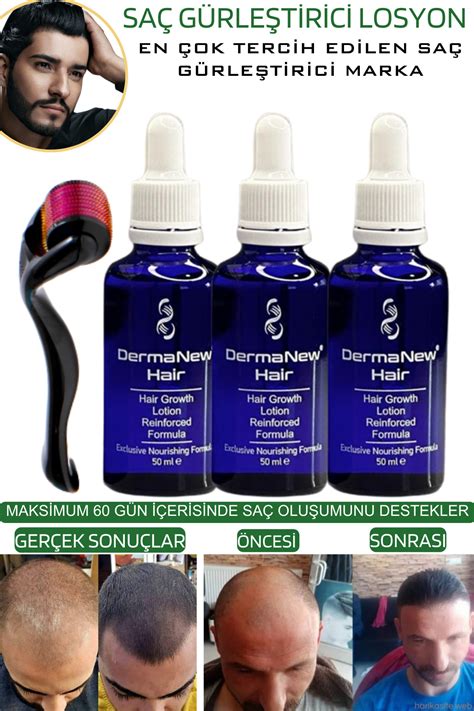 Dermanew Hair Saç Gürleştirici Serum Dökülme Karşıtı Şampuan Roller Hediyeli 5x50ml Fiyatı