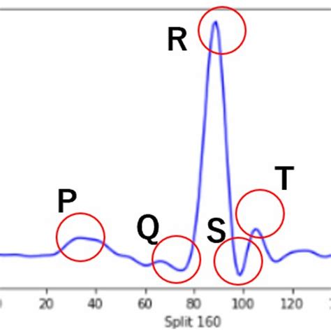 Illustration Of Each Label In An Ecg Signal Download Scientific Diagram
