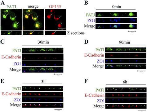 Localization Of Patj During Cell Polarization A Wild Type Mdckii Download Scientific Diagram