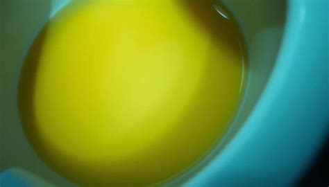 What Does C Diff Poop Smell Like Whiff Whisper