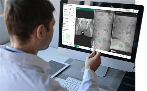 Intellijoint View™ Intellijoint Surgical