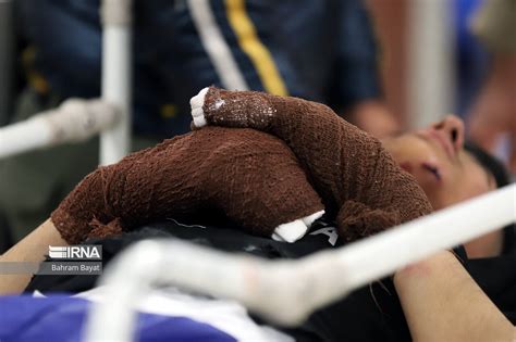 سه کارگر مصدوم با درجه سوختگی ۳۰ تا ۹۰ درصد در دامغان ایرنا