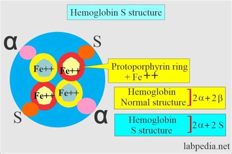 Anemia Part 5 A Sickle Cell Anemia And Sickle Cell Trait Discussion And Workup