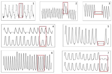 Anomaly Detection In Satellite Telemetry Data Using A Sparse Feature