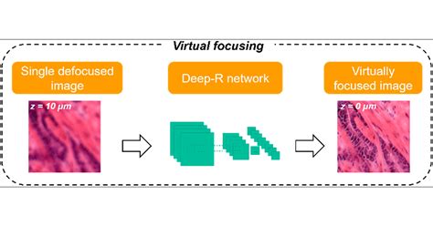 Single Shot Autofocusing Of Microscopy Images Using Deep Learning Acs