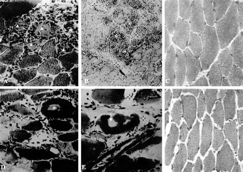 Histological Cross Sections Of Tibialis Anterior TA Muscle Of Rat And Download Scientific