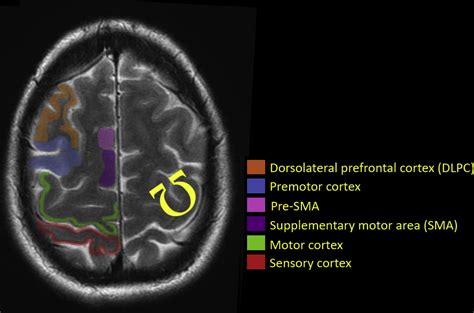 Functional Brain Anatomy Neuroimaging Clinics