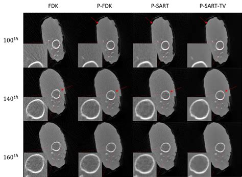 image gray value evaluation the reconstruction results of case 1 3 are