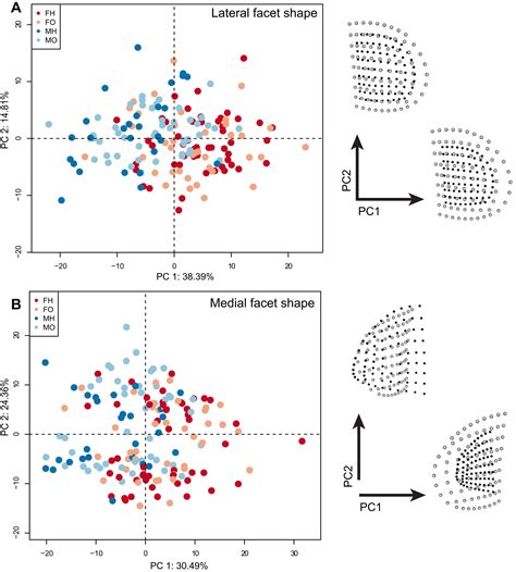 Sex Differences In Patellar Facet Shape Among Healthy And