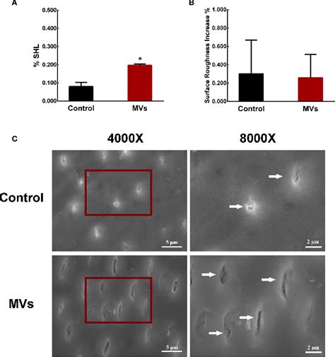 Figure 2 From Streptococcus Mutans Membrane Vesicles Enhance Candida