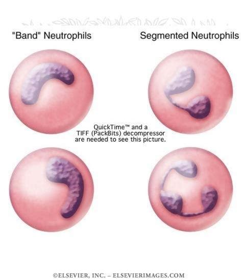 Band Neutrophil Or Staff Cell Medical Laboratories