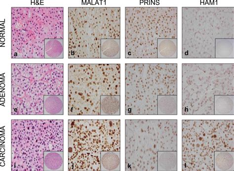 Hande Sections And Examples Of Ish Localization Of Malat1 Prins And