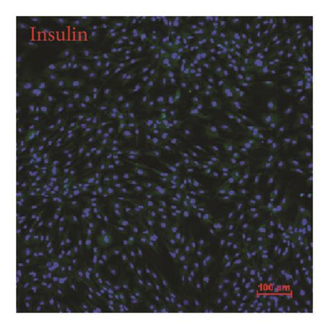 Immunofluorescence Staining Of Insulin In Rat Adscs Induced Into